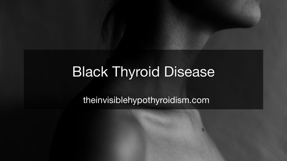 Black Thyroid Disease - The Invisible Hypothyroidism