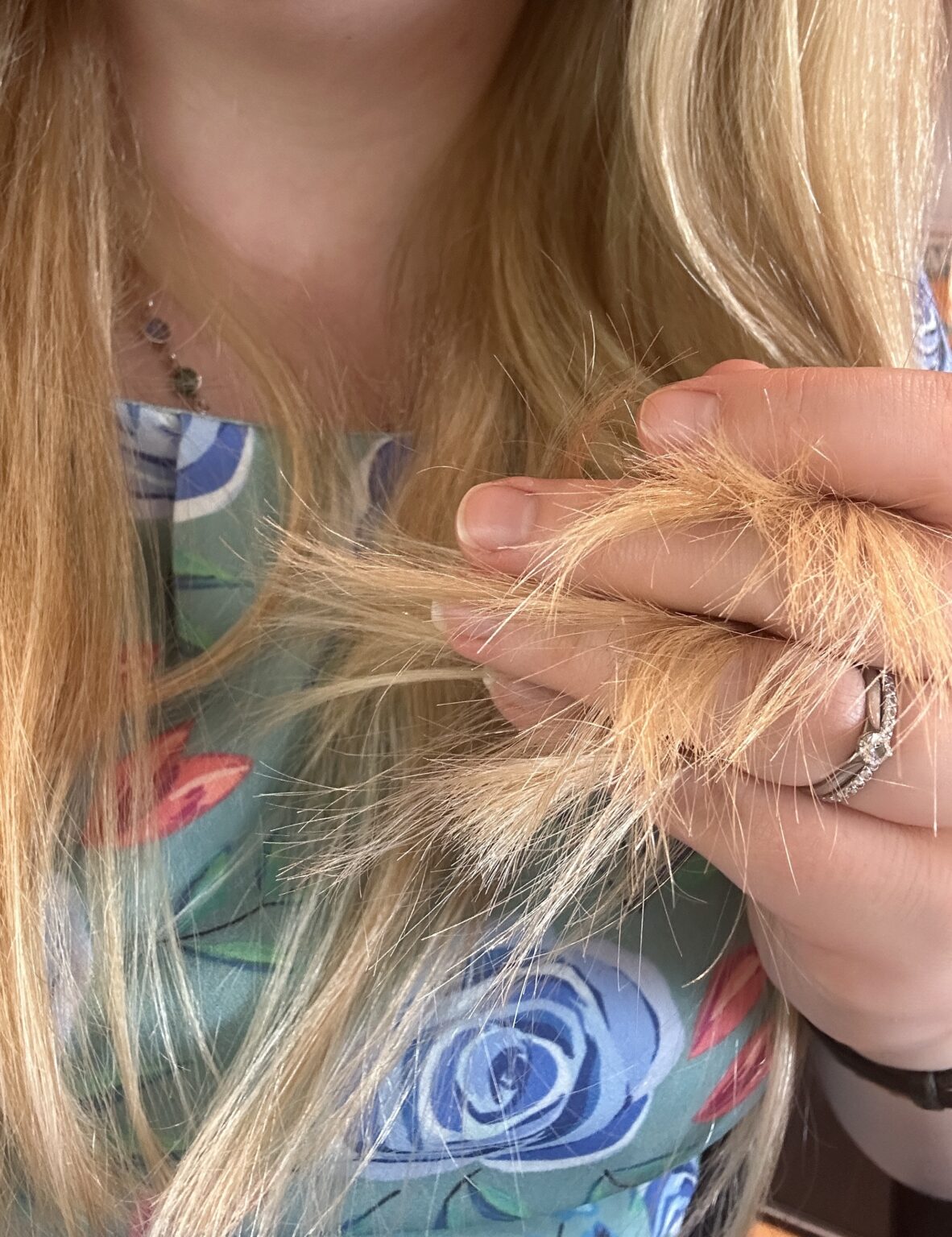 Brittle and Dry Hair With Hypothyroidism and Hashimoto’s - The ...
