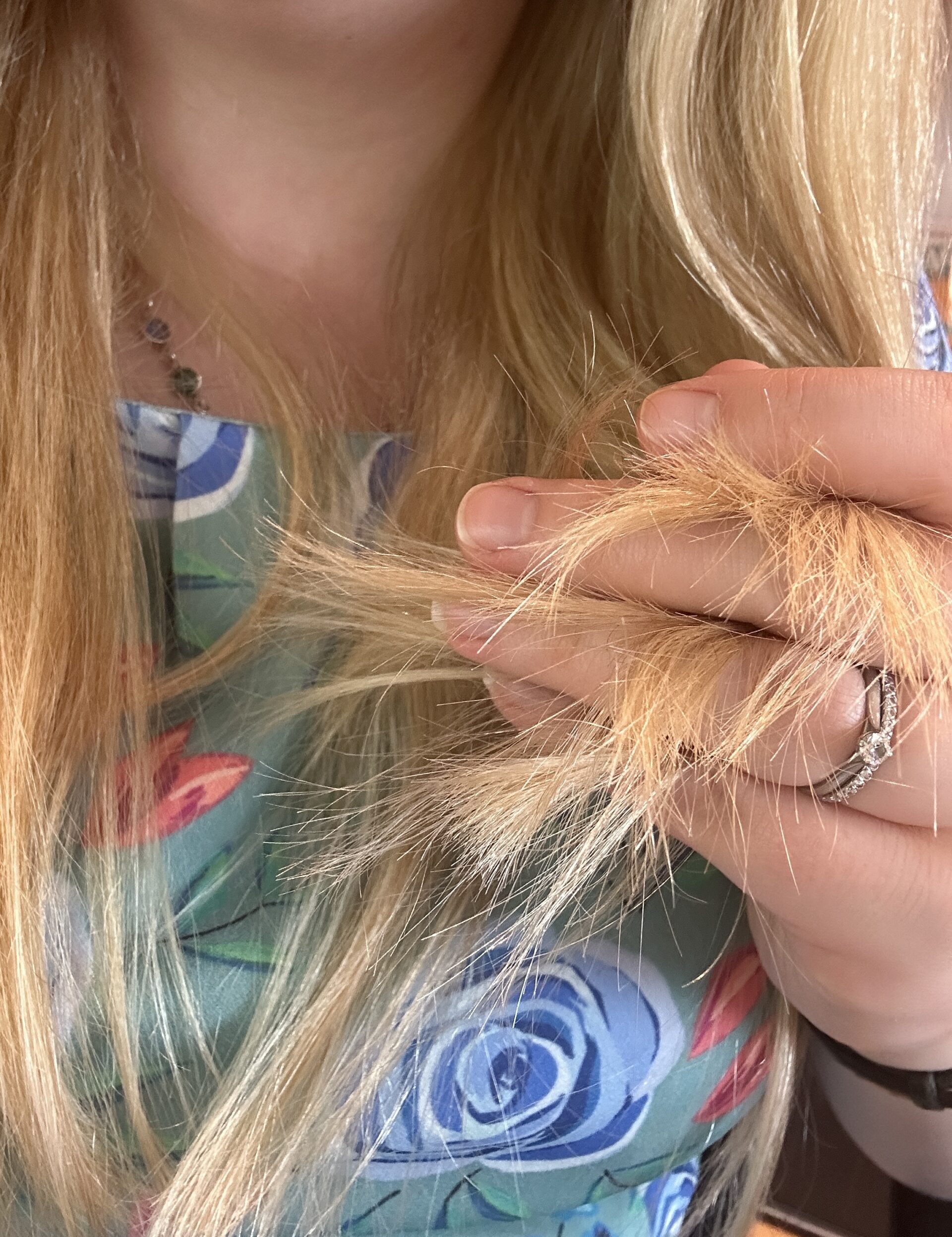 Brittle and Dry Hair With Hypothyroidism and Hashimoto’s - The ...